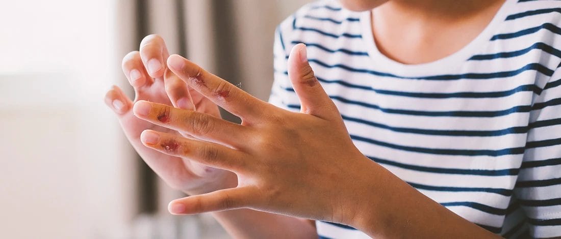 What Is An Exposure Incident? (Definition & Reporting)